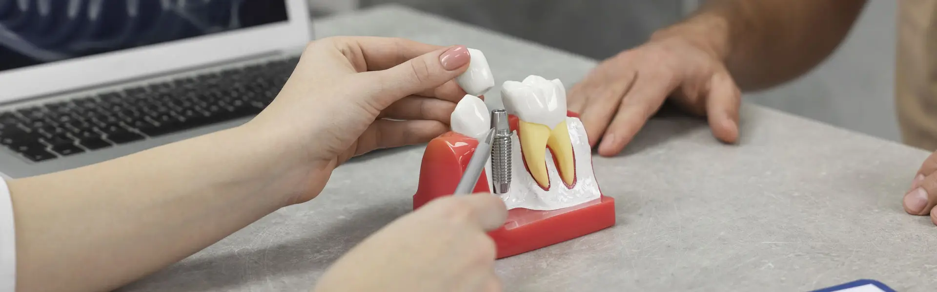 Stop Bone Loss And Restore Function With Dental Implants